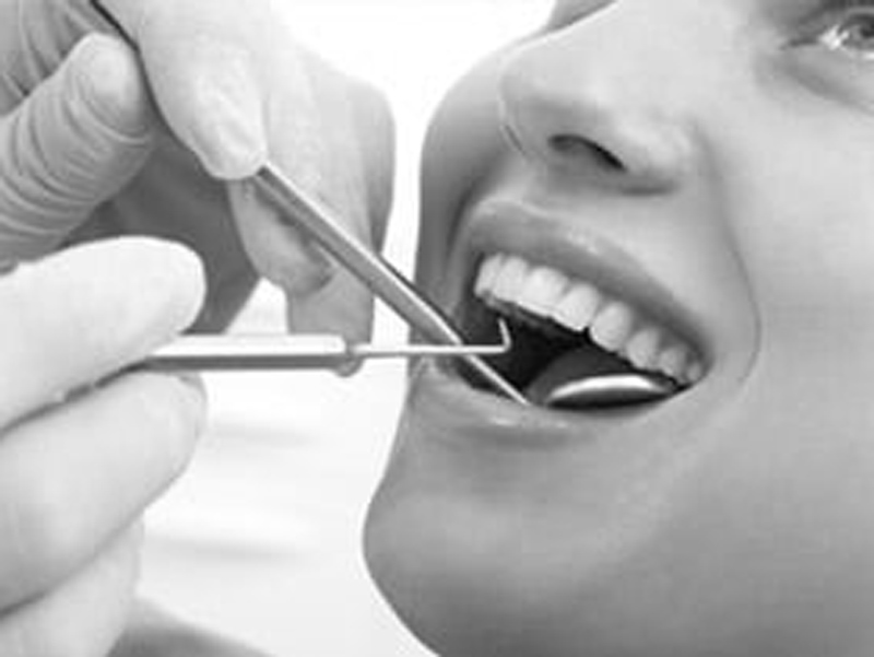 Crowns vs. Large Fillings: What's the Best Option? | Blackman Grove Dental